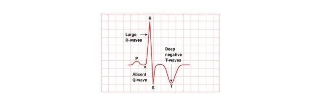 Cardiac Cycle Definition Anatomy And Physiology